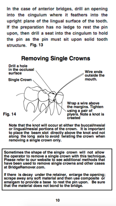 Sure Dental | Higa Bridge Remover Manual