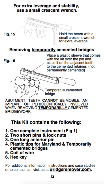 Sure Dental | Higa Bridge Remover Manual