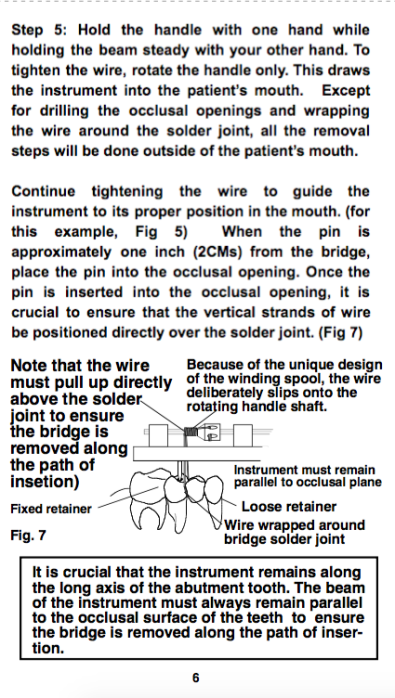 Sure Dental | Higa Bridge Remover Manual