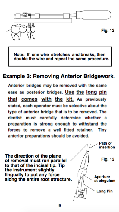 Sure Dental | Higa Bridge Remover Manual